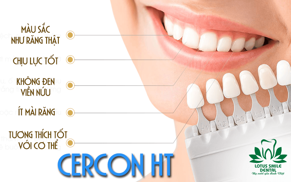 Sứ Cercon HT – Giải pháp phục hình răng sứ cao cấp tại Lab Hoàng Bảo ...
